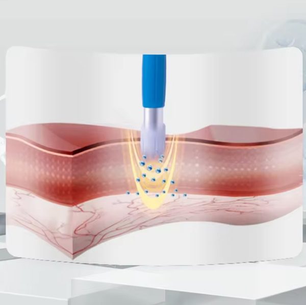 Pneumatic Shockwave Therapy Machine For Tendinopathy – Oxygenator Machine